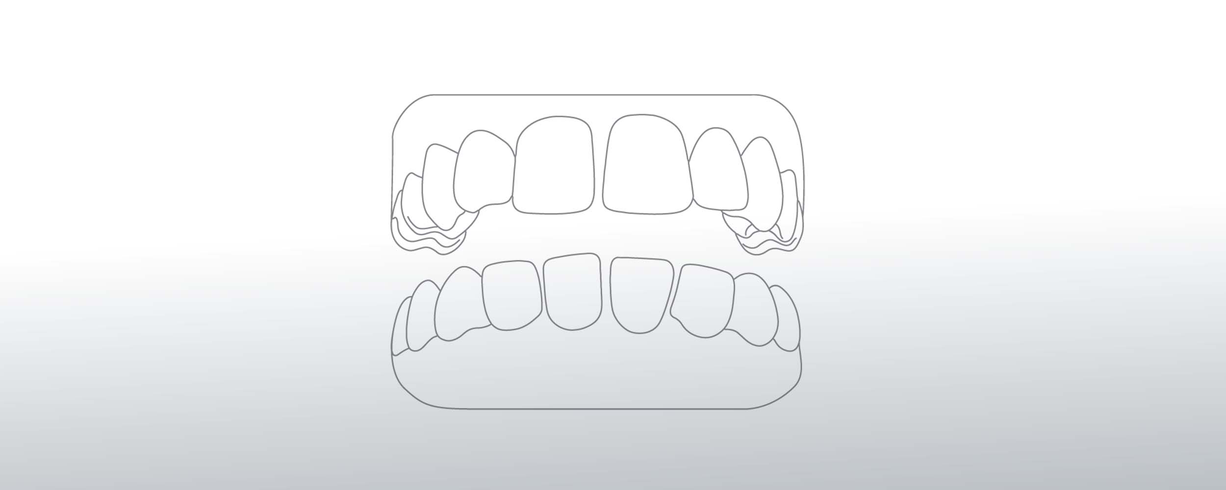 Gluggar mellan tänderna : Läs mer i vår Tandvårdsskola